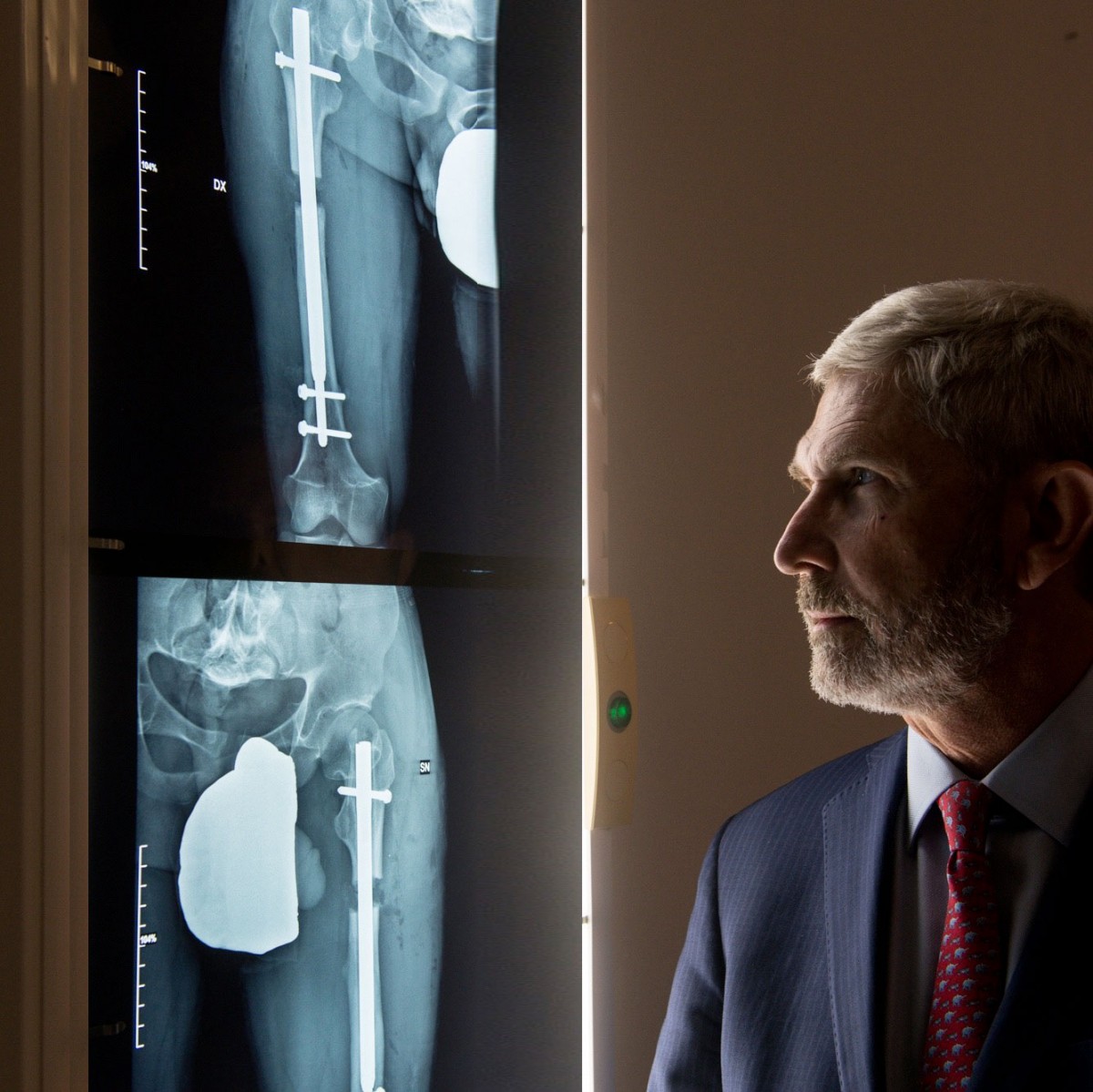 DR Guichet - The method